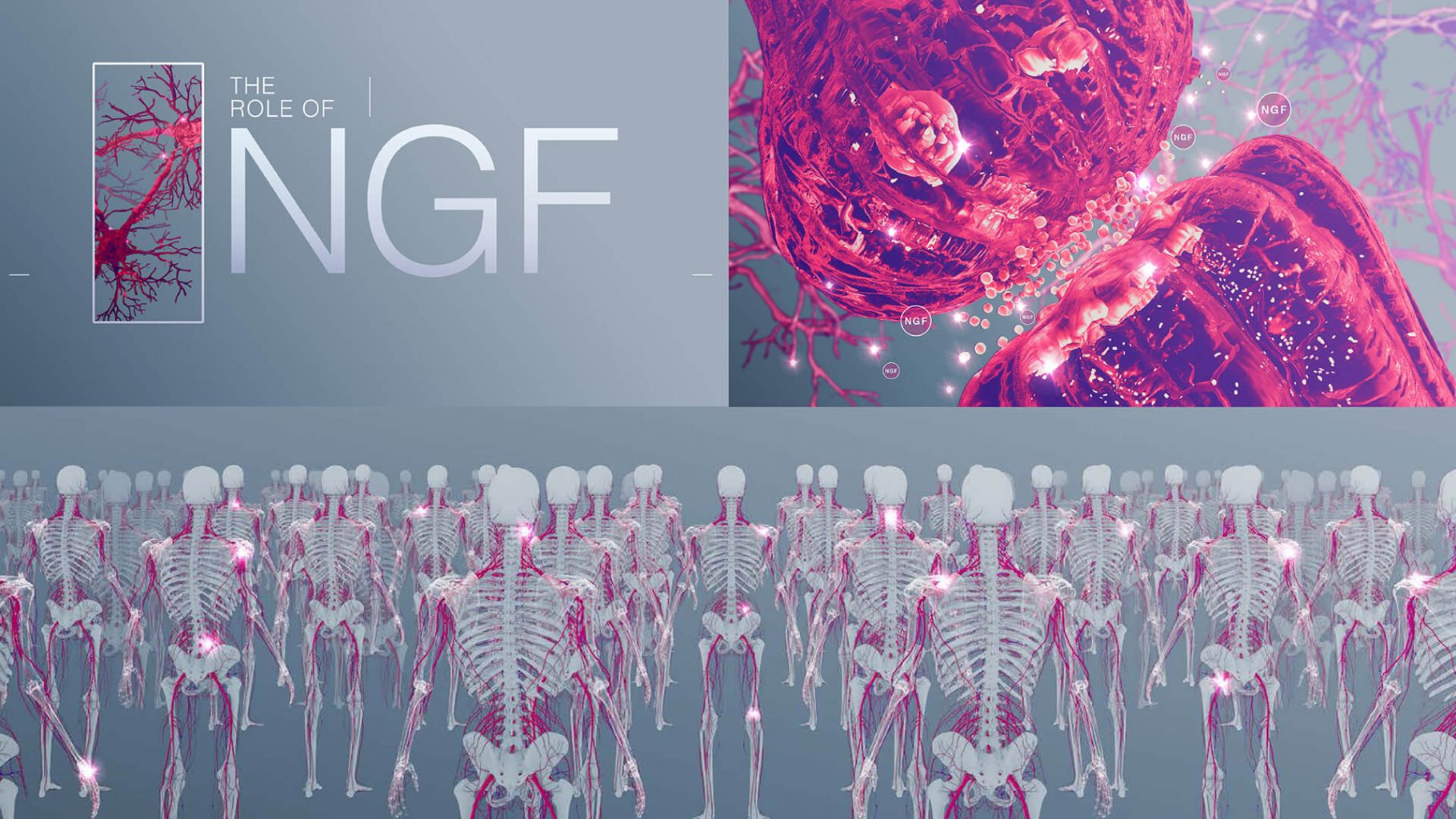 NGF Acute Pain - King and Country